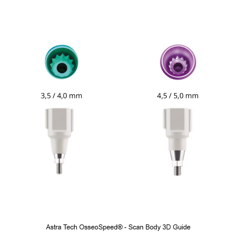 Nt-trading Astra Tech OsseoSpeed® – Scan Body 3D Guide – Doha Medical