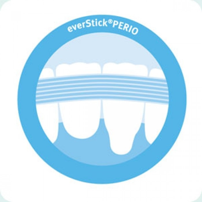 GC EverStick Perio – Doha Medical